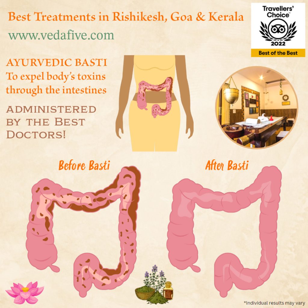 Basti (Medicated Enema Therapy) by Veda5, Best Ayurveda & Yoga Wellness ...